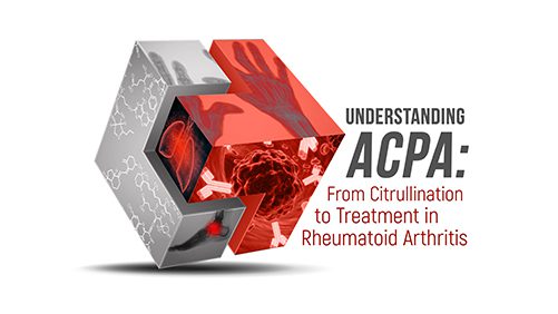 Understanding ACPA: From Citrullination to Treatment in Rheumatoid ...